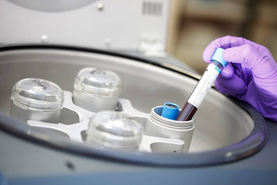 TEHNOLGIA ENDORET ® (PRGF ®) - Clinică stomatologică - Crystal Dental ...